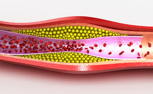 Talk About Cholesterol | Medical Alert | LifeFone